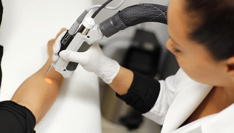 Types of Laser Treatments Calgary | Sarvi Studio